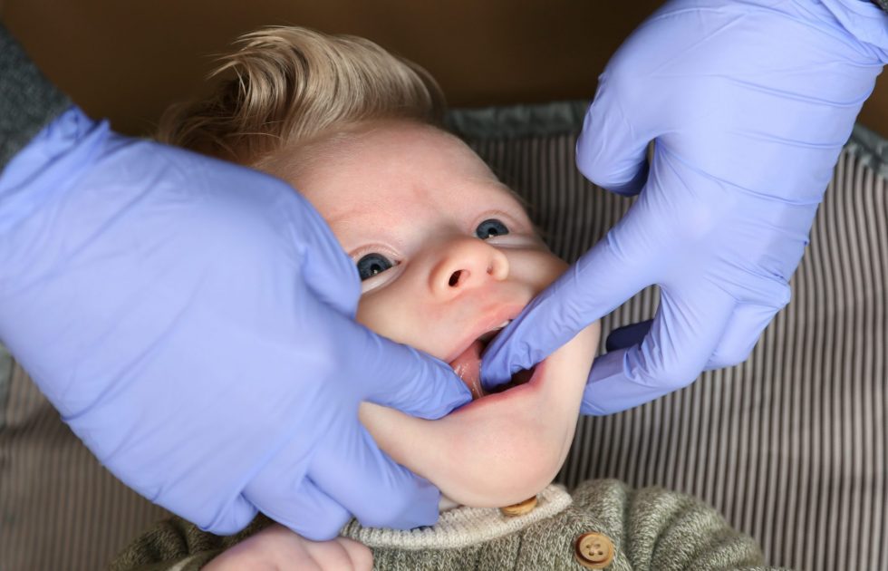 Orofacial Myofunctional Therapy | Anderson Smith Therapy Institute