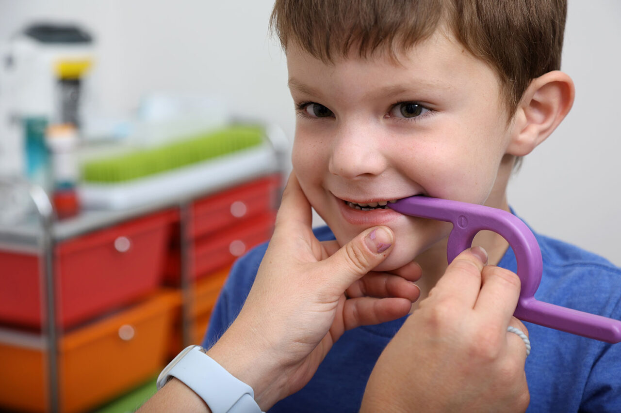 Orofacial Myofunctional Therapy | Anderson Smith Therapy Institute